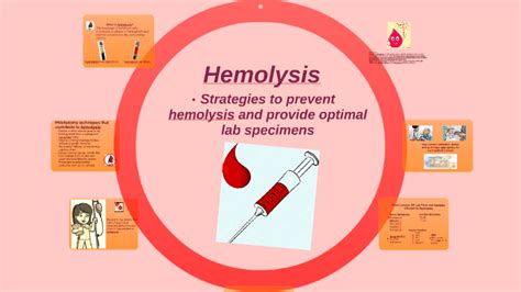 Hemolysis By Stephanie Skurtu On Prezi