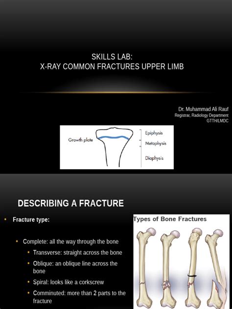 Fractures Of Upper Limb Pdf