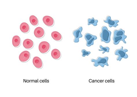 Cancer Cell Vs Normal Cell Microscope