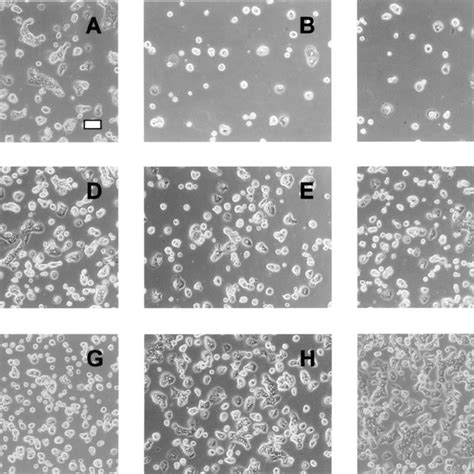 Freezing Protocol With The Controlled Rate Freezer Download