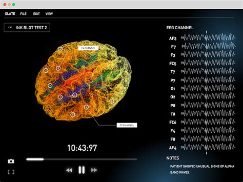 Eeg Data Visualization By Alice Yan On Dribbble