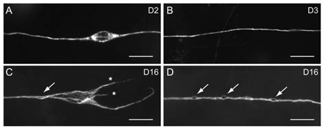 C Elegans Model Of Neuronal Aging Abstract Europe Pmc
