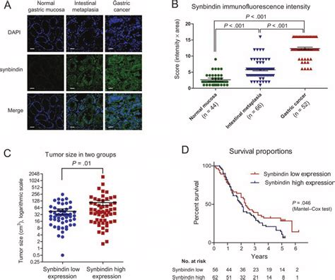 Relationship Between Synbindin Expression And Outcome Of Gastric