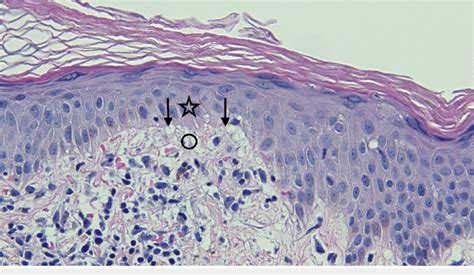Closer View Of The Microscopic Examination Of Testopelassociated