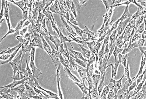 血管内皮细胞白细胞吞噬细菌动态图白细胞吞噬细菌第2页大山谷图库