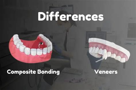 Composite Bonding Vs Veneers Which Is Right For You Dental Scotland