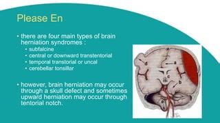 Cerebral Herniation Syndromes Pptx