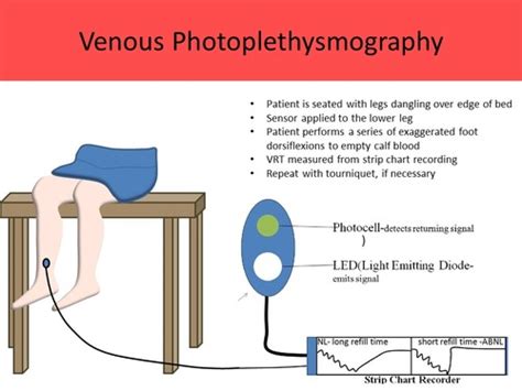 Venous Photoplethysmography Flashcards Quizlet