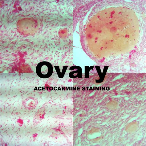 Ovary In Acetocarmine Staining Rhistology