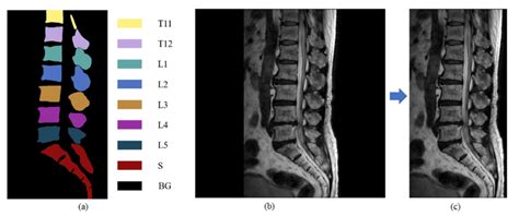 Schematic Diagram Of Spine Data Processing And Labeling A Is The Download Scientific Diagram