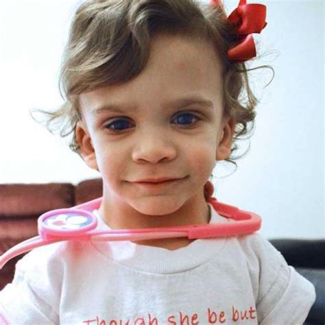 سندرم ترنر اختلال کروموزومی در نوزادان دختر نحوه تشخیص سندرم ترنر راه های درمان سندرم ترنر