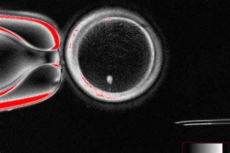 Biologists Turn Skin Cells Into Human Eggs In Groundbreaking Experiment