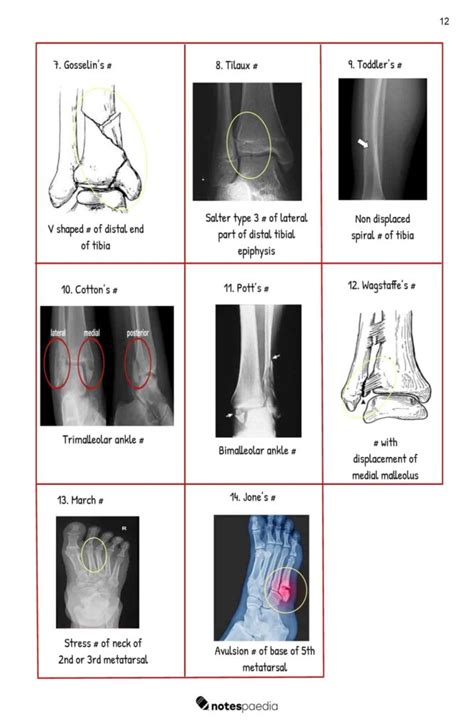 Elite Orthopedics Notespaedia