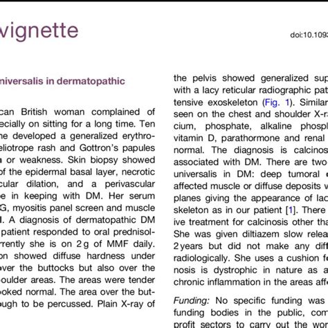 Plain X Ray Of The Pelvis Showing Generalized Superficial Calcification