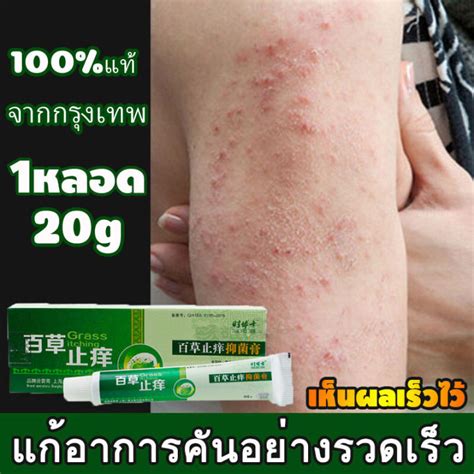 Grass Itching ครีมคัน แก้กลากสะเก็ดเงินสะเก็ดเงิน สูตธรรมชาติ แซมความ