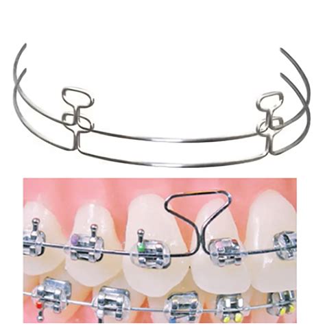 Osl Stainless Steel T Loop Archwires Pack Of 10