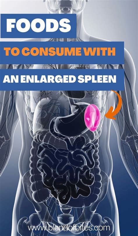 Foods To Avoid If You Have Enlarged Spleen Experts Advice Artofit