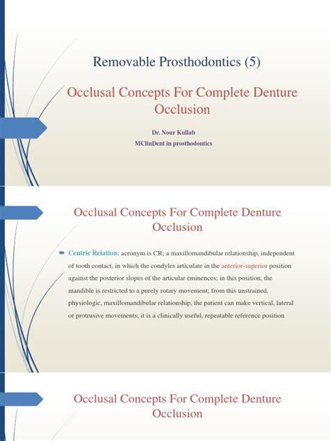 7 Occlusal Concepts For Complete Denture Occlusion1 Pdf Dentures