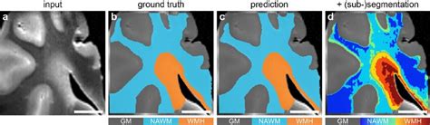 Overview Of Segmentation Pipeline A Post Mortem High Field