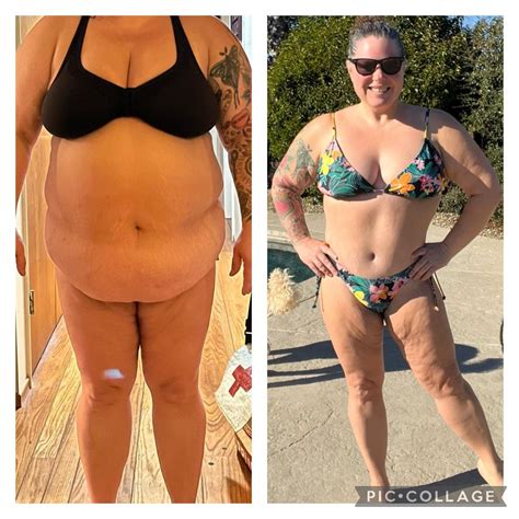 One Year Post Op For Plus Size Mommy Makeover In A String Bikini For