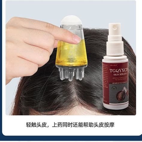 Tinea Capitis Follicle Inflammation Seborrheic Skin Inflam头癣毛囊焱脂溢性皮焱头皮真感染抑菌脂溢性加上药器外用喷剂gpdd