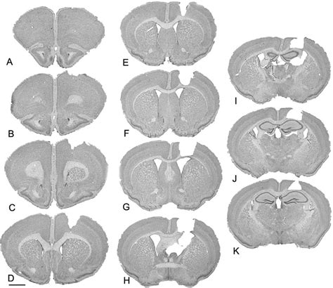 The Extent Of Gross Morphology Of The Cortical Aspiration Lesion In A Download Scientific