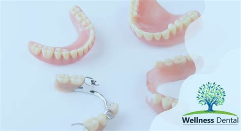 Flipper Tooth Affordable Temporary Tooth Replacement Option