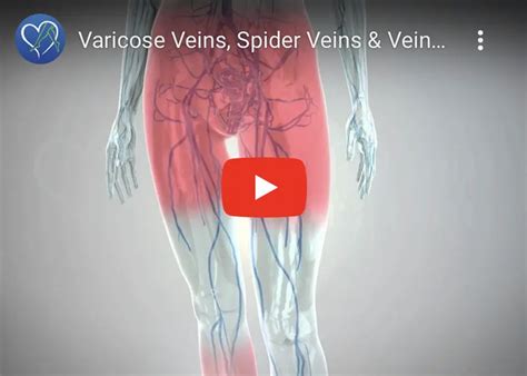 Vascular Doctors And Surgeons In Maryland Virginia And New Jersey