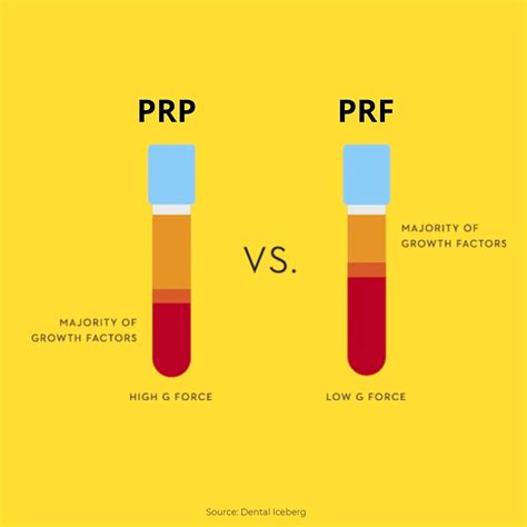 Prp Prf And Advanced Prf A Quick Comparative Analysis