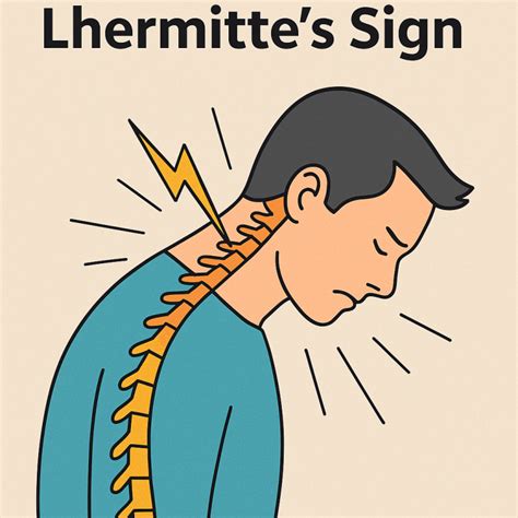 신경외과 전문의가 설명하는 렐미트 사인lhermittes Sign 네이버 블로그
