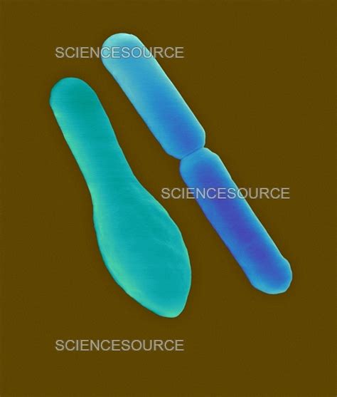 Clostridium Sporogenes Spore Forming Stock Image Science Source