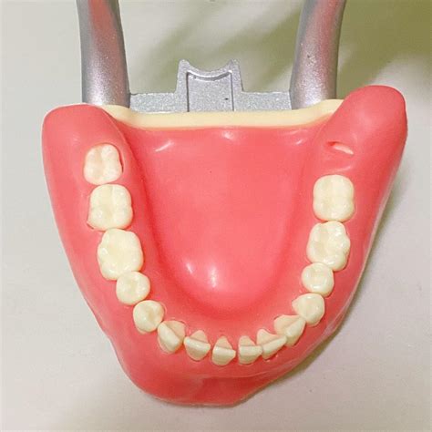 Oral Surgery Jaw Impacted 3rd Molar Case Beauty And Personal Care