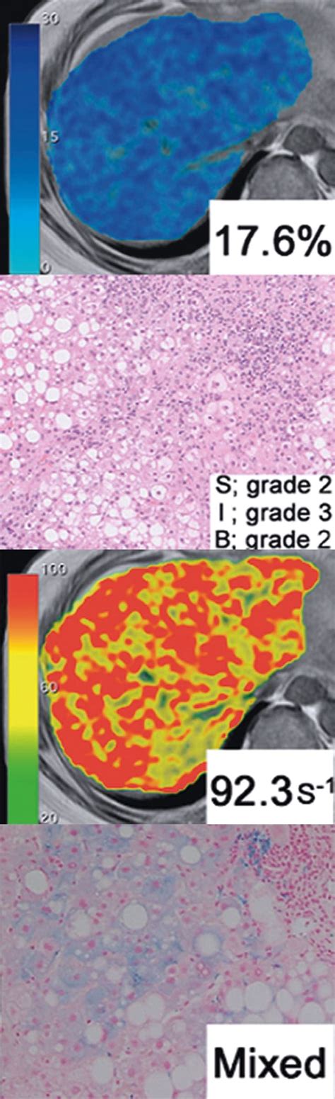 Developing An Evidence Based Liver Mr Imaging Service