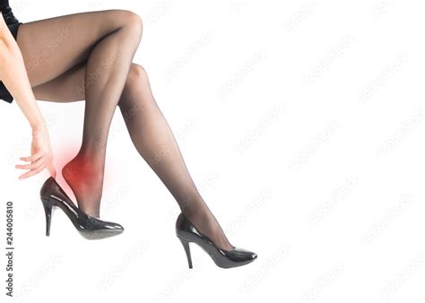 Female Legs With Injured Heels By Tight High Heels Isolated On White