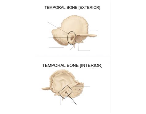 Temporal Bone Landmarks Quiz