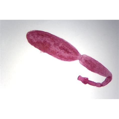 Echinococcus Granulosus Adult W M Medical And Science Media