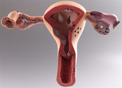 Colposcopy Dr Shilpa Bansal Agrawal