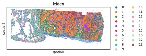 Analyze Xenium Data — Squidpy Documentation