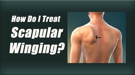 5 Best Strengthening Exercises To Fix Scapular Winging Youtube