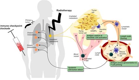 Abscopal Immunological Effects Of Radiotherapy Narrowing The Gap Between Clinical And