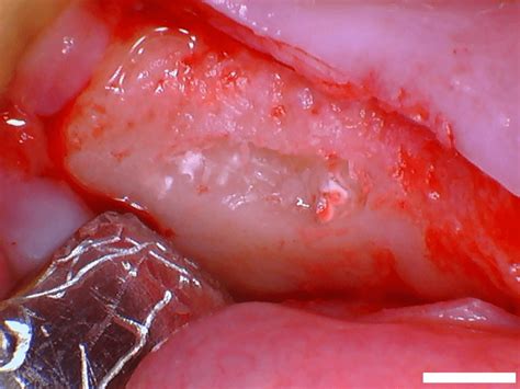 Killing Bacteria Wipes Out Regenerative Cells Steinerbio