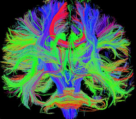 Diffusion Mri Mapping The Structural Highways Of The Brain Neuwrite