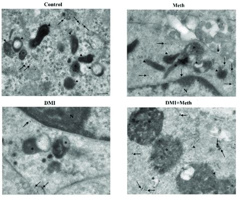 Representative Tem Micrograph Of Lc3 Compartmentalization Following Dmi