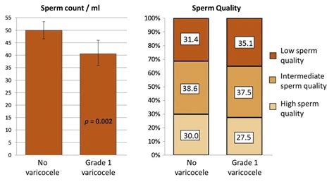 Varicocele And Fertility Fertility Science