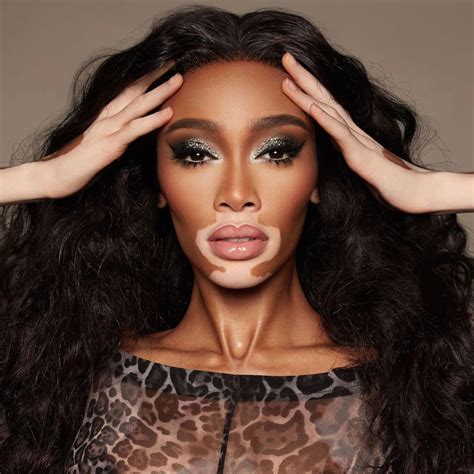 Winnie Harlow Su Beyesa Singular Focus