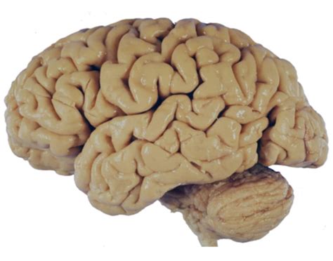Thalamic Nuclei Projections Quiz