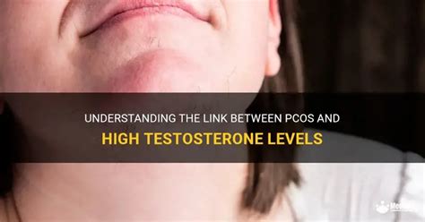 Understanding The Link Between Pcos And High Testosterone Levels Medshun