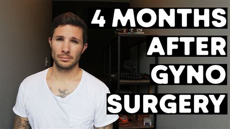 4 Months After Gynecomastia Surgery Gynecomastia Recovery Update