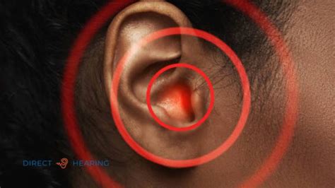 Uncovering The Causes Of Why Does My Ear Keep Popping