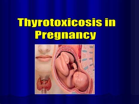 Thyrotoxicosis In Special Situation The Let Ppt Free Download